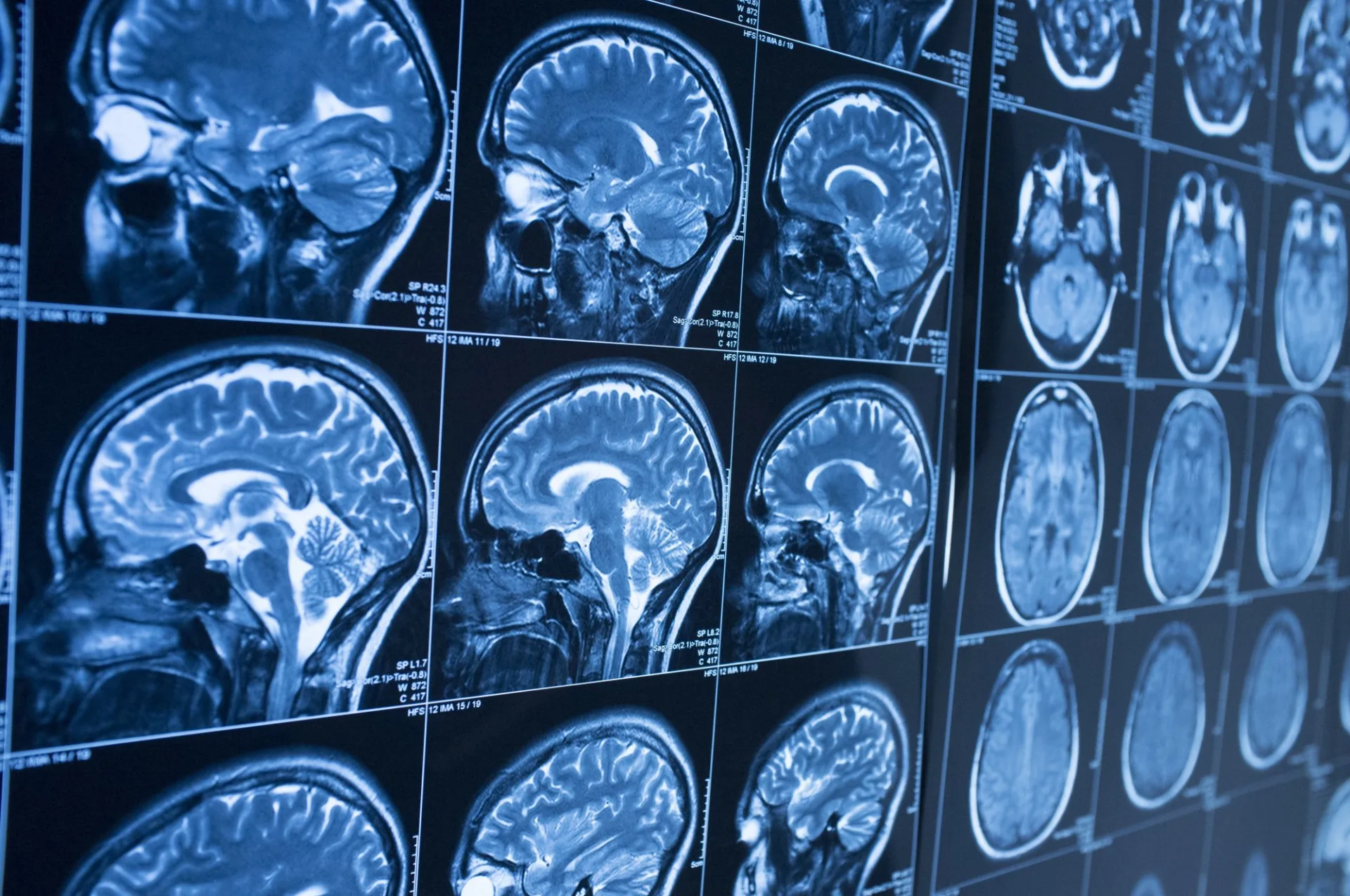 This Is What Your Couch Potato Lifestyle Is Doing to Your Brain