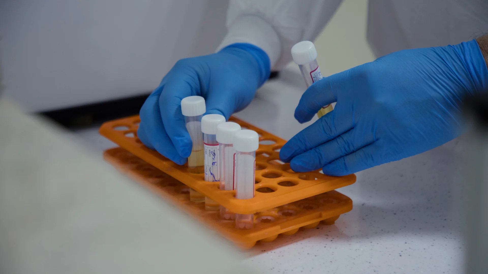 A $435 Million Bet on 'Reversing Aging'