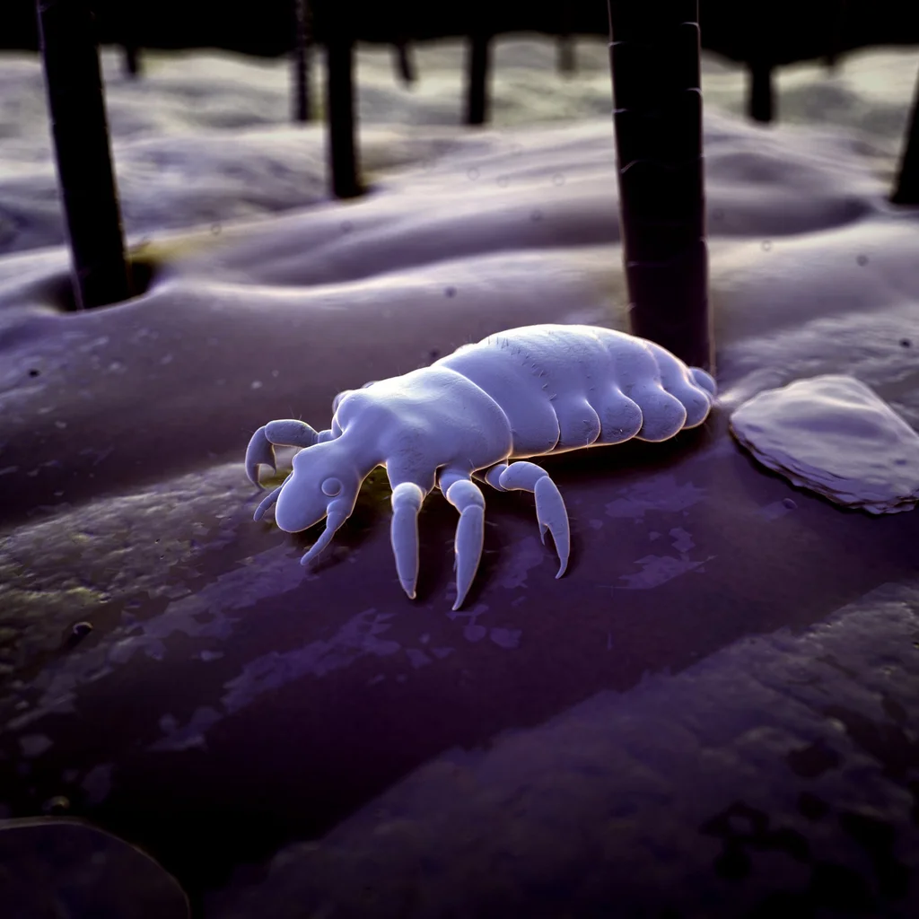 Forget Toxic Chemicals. This New Technology Can Kill Super Lice With ...