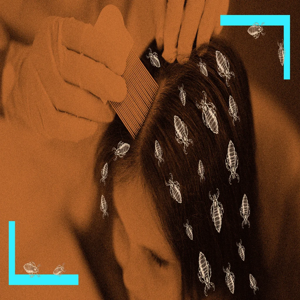 We Make Louse Calls! A Creepy Old Problem Is Being Tackled by a New ...